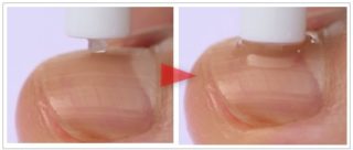 ルコナックとクレナフィンを徹底比較！効果、副作用、使い方、薬価（爪水虫塗り薬） | めでぃすた ｜ 現役薬剤師が本音で語るおくすり情報局